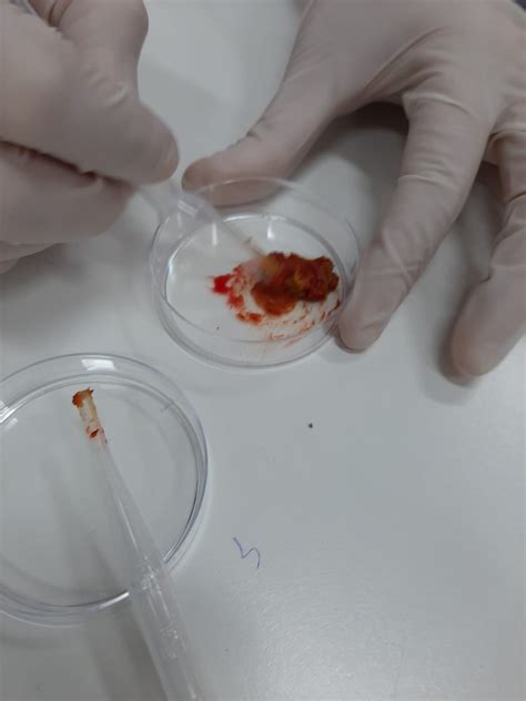Práctica 22 Sangre oculta en heces