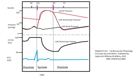 Wiggers Diagram Aortic Regurgitation