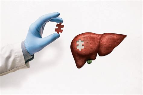 Transplante de Fígado Quando é indicado cirurgia e recuperação
