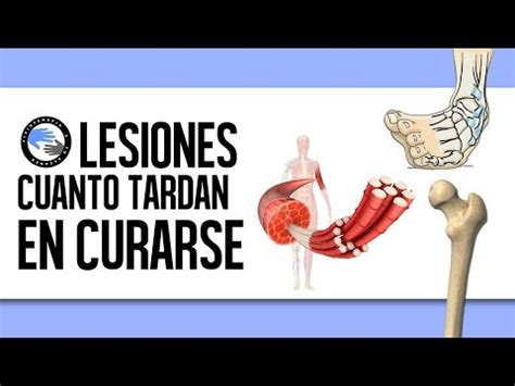 Cuanto Tarda En Sanar Una Fisura Sale Smarys Org