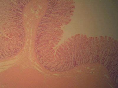 Large Intestine Histology Large Intestine Histology Slide