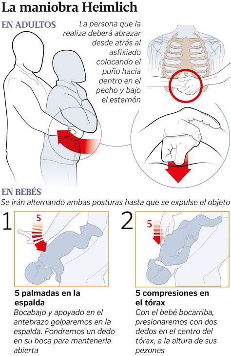 La maniobra de Heimlich guía de instrucciones