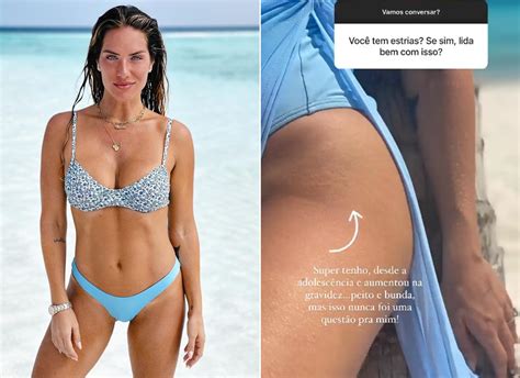 Giovanna Ewbank Mostra Estrias E Diz Que Lida Bem Nunca Foi Uma