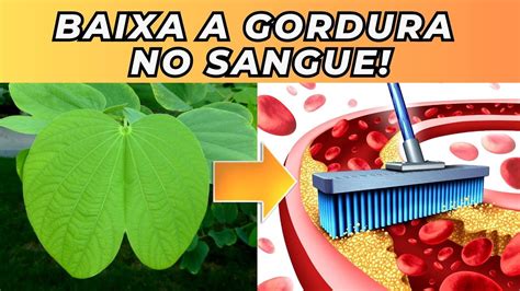 Dicas Pr Ticas Para Baixar Os Triglicer Deos Dr Dayan Siebra Youtube