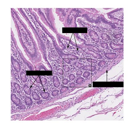 Small Intestine Histology Diagram Quizlet
