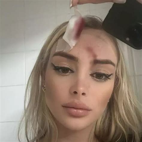 Vídeo imagens mostram momento em que modelo é atacada garrafada em