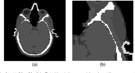 figure 1 from development and optimization of regularized tomographic reconstruction algorithms