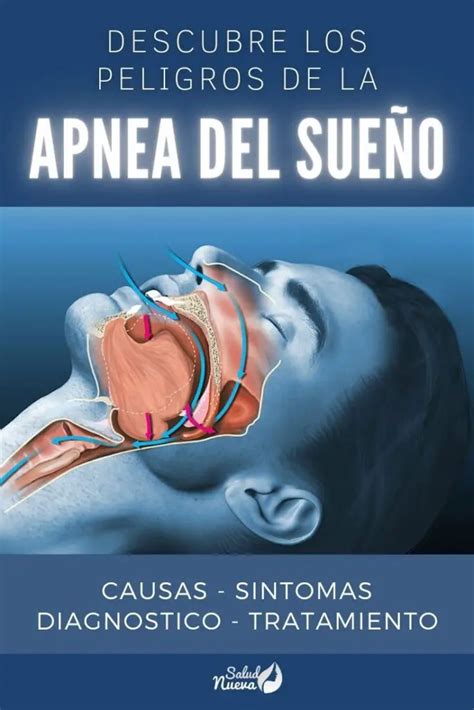 Qué es la apnea del sueño Causas y tratamiento