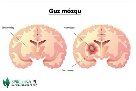 Guz M Zgu Algi Spirulina I Chlorella