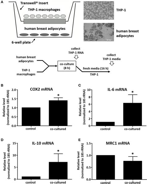 Human Adipocyte Macrophage Co Culture System And Phenotype