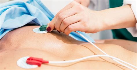 Cómo colocar electrodos en los diferentes procedimientos sanitarios