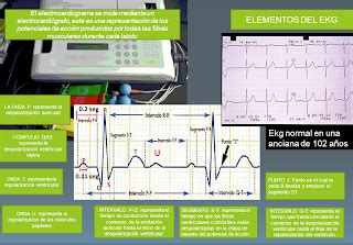 Fisiologia UAS De Gilfredo Enrique Castro Alcantar ELEMENTOS DEL EKG