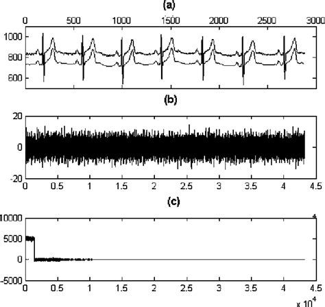 figure 1 from electrocardiogram compression method based on the adaptive wavelet coefficients
