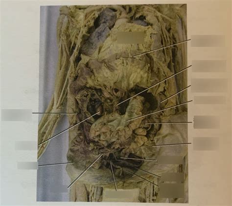 The Digestive Organs Cadaver Diagram Quizlet