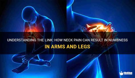 Understanding The Link How Neck Pain Can Result In Numbness In Arms