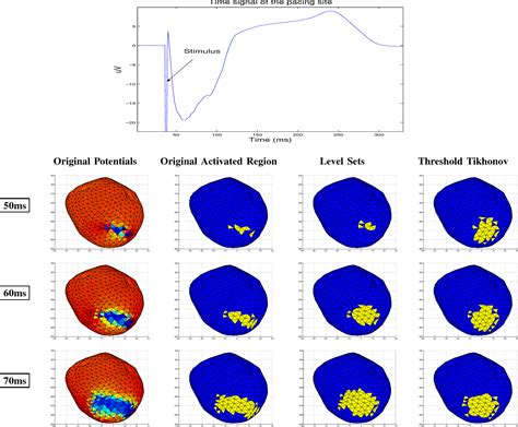 figure 3 from a level sets algorithm for the inverse problem of electrocardiography semantic