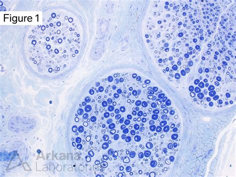 Toluidine Blue Stained Thick Section Neuro Notes Arkana Labs