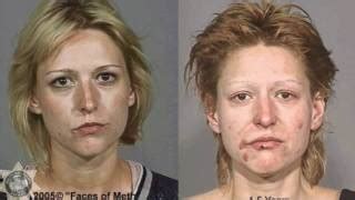 Antes Y Despues De Las Drogas