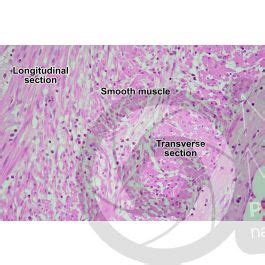 Mammal Smooth Muscle Transverse Section 125X Smooth Muscle