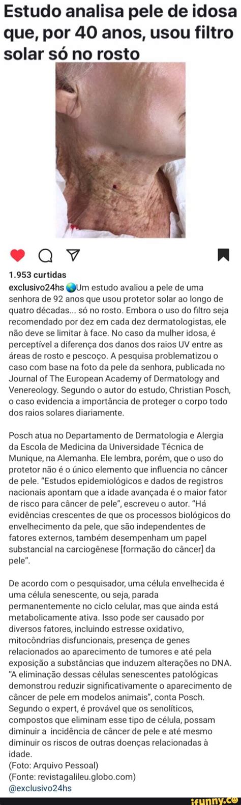 Estudo Analisa Pele De Idosa Que Por Anos Usou Filtro Solar S No