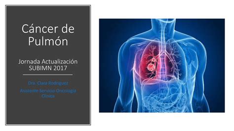 PDF Cáncer de Pulmón Cáncer de Pulmón Jornada Actualización SUBIMN