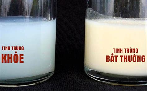 Các kiểm tra tinh trùng bằng mắt thường và những điều cần lưu ý