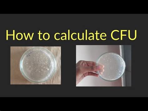 How To Calculate Colony Forming Unit CFU Colony Count