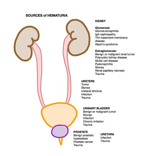 Hematuria Causes Symptoms Homeopathic Treatment