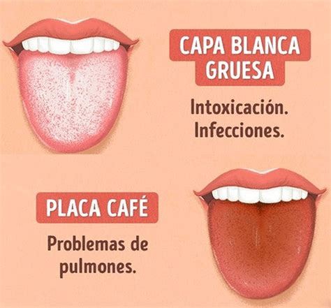 El Color De Tu Lengua Revela Tu Estado De Salud En Total Son