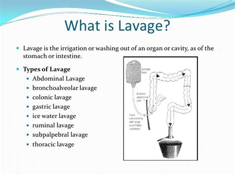 Lavage Hernioplasty Extraction And Anastomosis