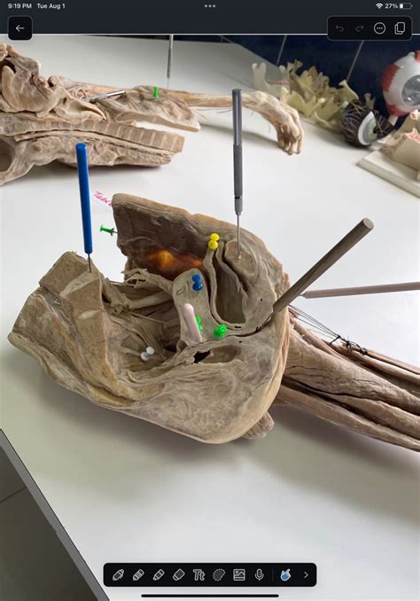 Solved Label The Colored Thumbtacks On The Pelvis Chegg