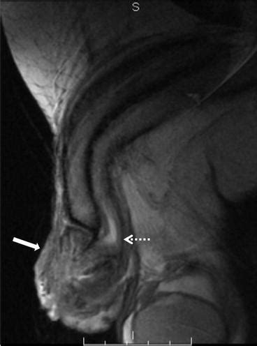 Male Pelvis Radiology Key