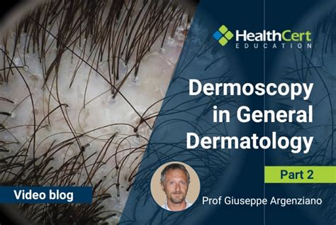 Dermoscopy In General Dermatology Part 2