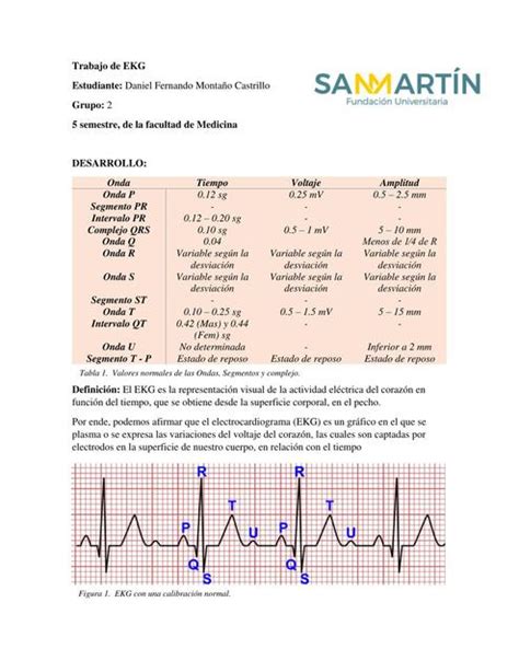 EKG Daniel Montaño uDocz