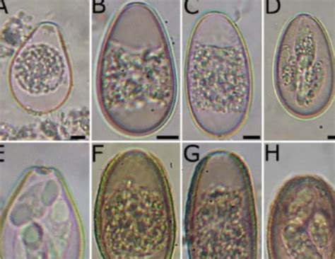 Protozoa Flashcards Quizlet