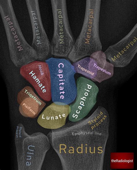 TheRadiologist On Twitter Carpal Bone Anatomy