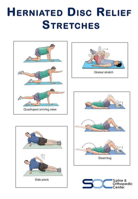 Cervical Disc Herniation Exercises