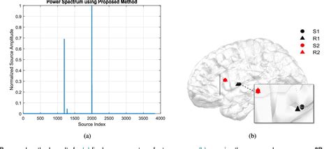 figure 5 from brain source localization using stochastic gradient descent semantic scholar