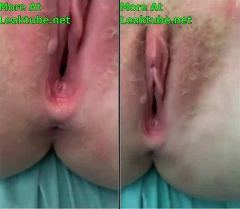 Pictures Showing For Nude Albino Girl Porn Mypornarchive Net