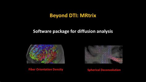 Introduction To MRtrix YouTube