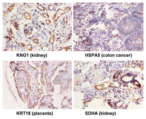 Ihc