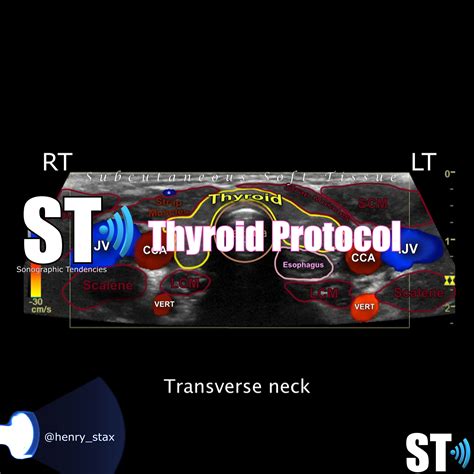 Thyroid Ultrasound Protocol Sonographic Tendencies