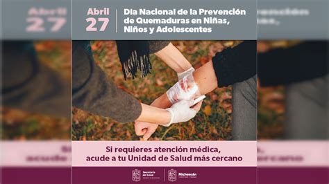 Llama Salud Michoacán a extremar precauciones para evitar quemaduras en