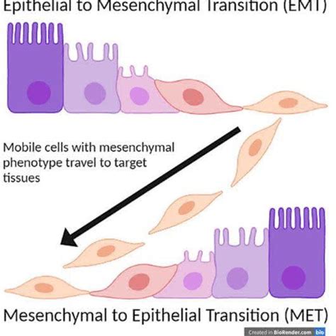 Epithelial To Mesenchymal Transition EMT And Mesenchymal To