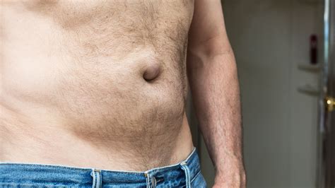 Hernien Ursachen Behandlung Vorbeugung Gesund Bund De