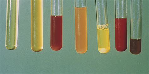 Fluid Cytology Flashcards Quizlet