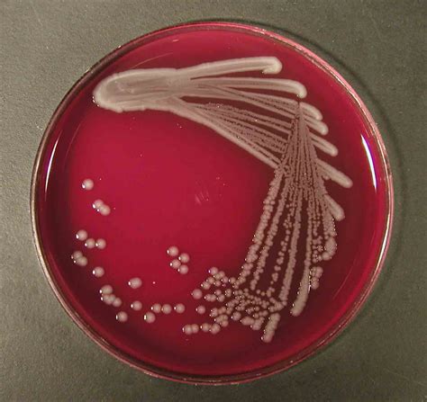 E Coli Colony Morphology On Macconkey Agar Plate