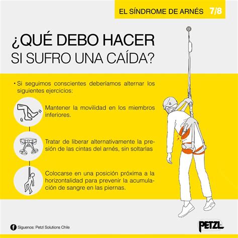 Que es el síndrome del arnés