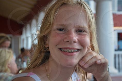 Braces Face Girl Teeth Teenager Smile Brace Face Cute Teen Teenager