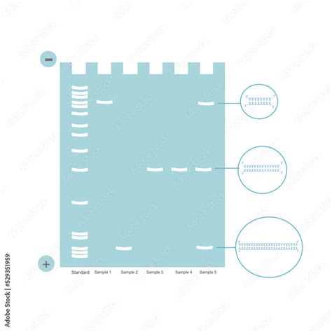 The Gel Electrophoresis Technique That Separated The Different Size Of